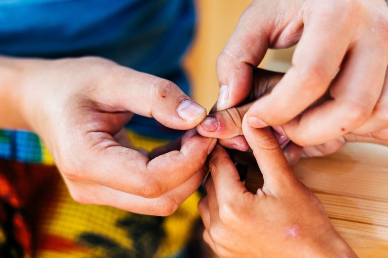 How to Give Your Wound the Best Care | St Luke's Hospital